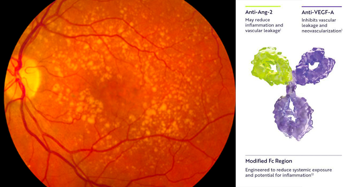 Novidade no tratamento das doenças retinianas mais prevalentes no mundo ...